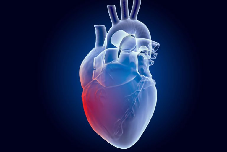 Unraveling the Symptoms of Swelling in the Heart